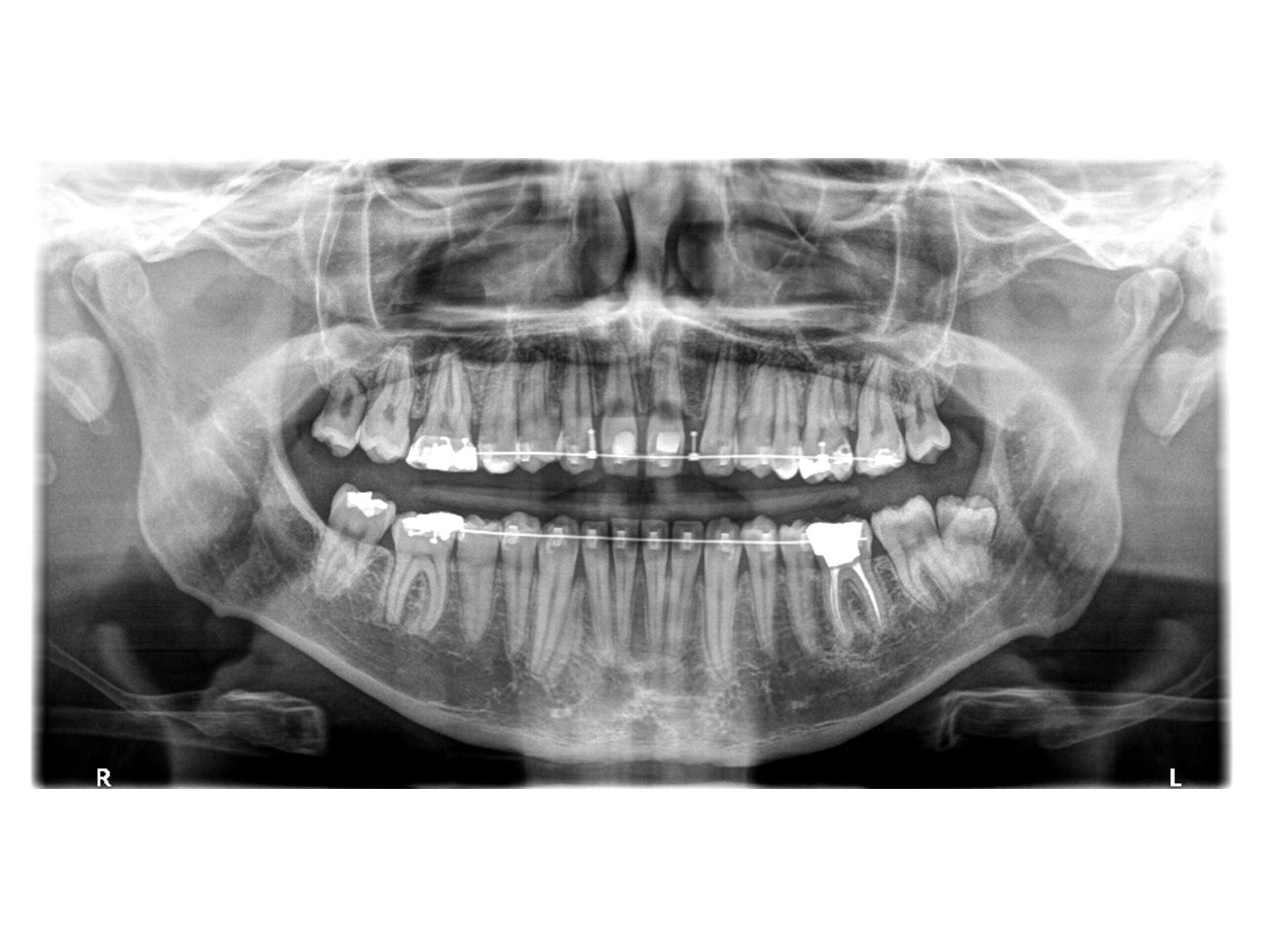 CS 8100 SC 3D - Spezialisten für dentale Radiologie