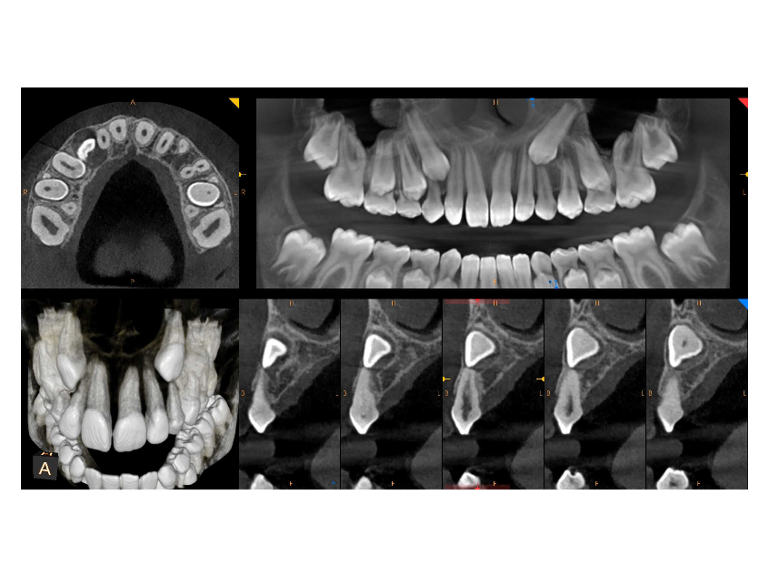 CS 8100 SC 3D - Spezialisten für dentale Radiologie